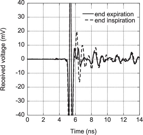 Figure 1 From Breath Activity Monitoring With Wearable Uwb Radars