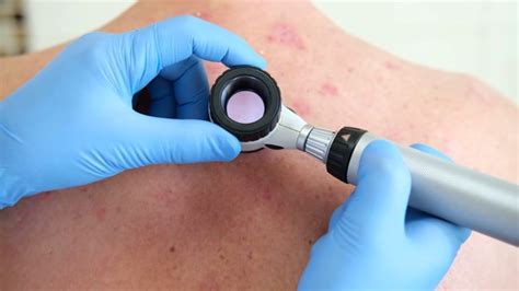 Dermatology Consultation Stock Footage Royalty Free Video Clips Storyblocks