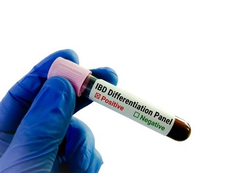 Ibd Test Images Free Download On Freepik
