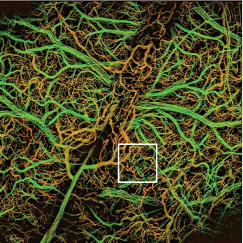 Three Dimensional Wide Field Fluorescence Microscopy For Transcranial Mapping Of Cortical