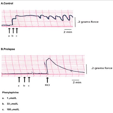 Representative Anterior Vaginal Muscularis AVM Force Tracing A In Download Scientific
