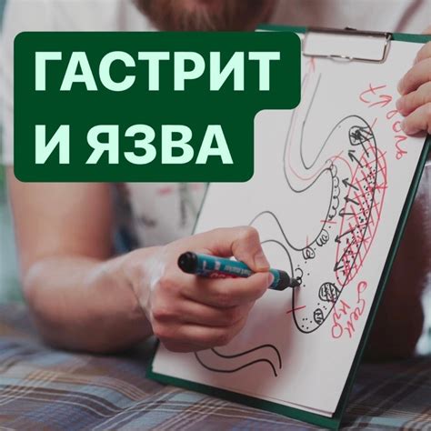 Тимофей Кармацкий 2024 | ВКонтакте