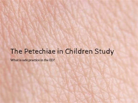 Jc Spot The Difference What Can We Do About Petechiae St Emlyns