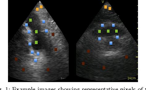 figure 1 from an automated bladder volume measurement algorithm by