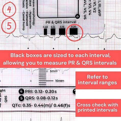 Electrocardiogram 7 Step Ruler For Ekg Interpretation Portable Ecg