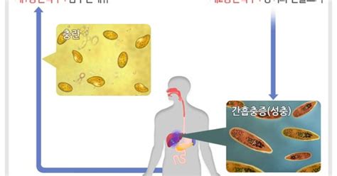 ‘암 유발 기생충 감염률 3 7 …자연산 민물고기 생식이 원인