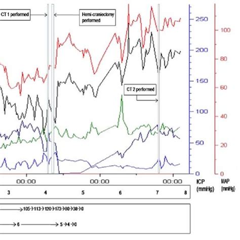 Intracranial Pressure ICP Cerebral Perfusion Pressure CPP Mean Download Scientific