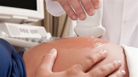 Sex Linked Recessive Inheritance Antenatal And Postnatal Screening