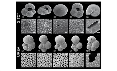 Foraminifera Microscope Labeled Foraminifera Microscope Labeled