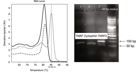 Figure 1 From Tnf Receptor Type 1 And Tnf Receptor Type 2 Mrna Expression Was Not Associated