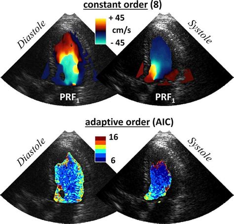 Aic Based Adaptive Clutter Filter Top Color Doppler Estimates Download Scientific Diagram