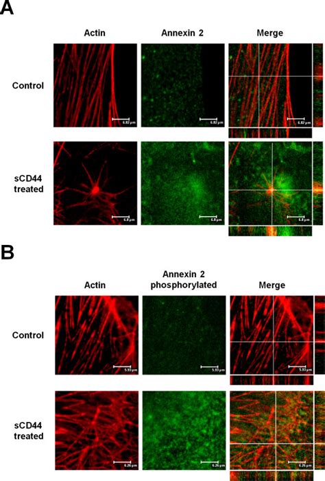 Confocal Microscopy Of Scd44 Treated Human Trabecular Meshwork Cells Download Scientific