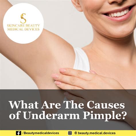What Are The Causes Of Underarm Pimple What Are The Causes Of Underarm Pimple