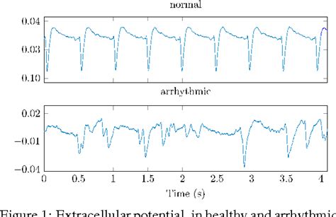 Figure From Classification Of Cardiac Arrhythmia In Vitro Based On Multivariate Complexity