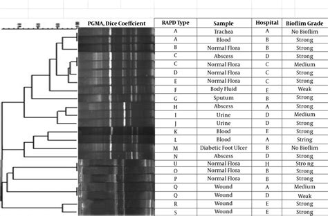 Dendrogram Cluster Analysis Of Random Amplified Polymorphic Dna