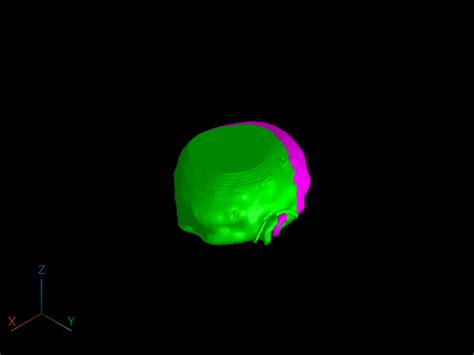 register multimodal medical image volumes with spatial referencing