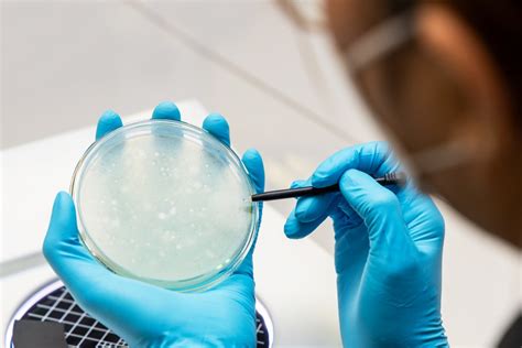 Trichomoniasis And Infertility