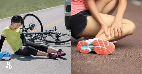 The Ultimate Guide To The Treatment Of Fractures In Singapore