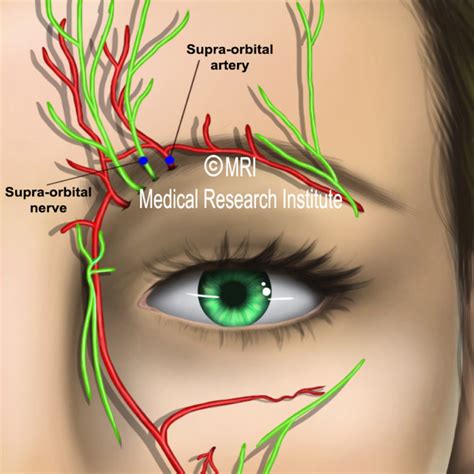 Treating Headaches With A Cervical Nerve Block