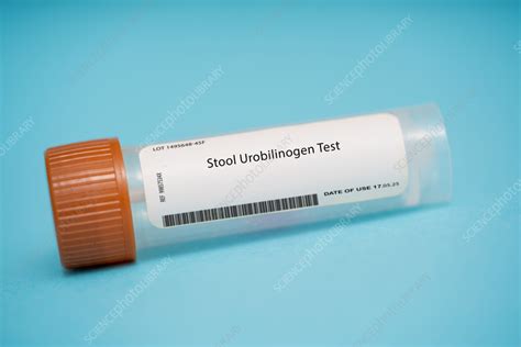 Stool Urobilinogen Test Stock Image F0420334 Science Photo Library