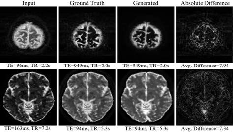 Re Parameterization Results For Param To Param Model Signal Intensity Download Scientific