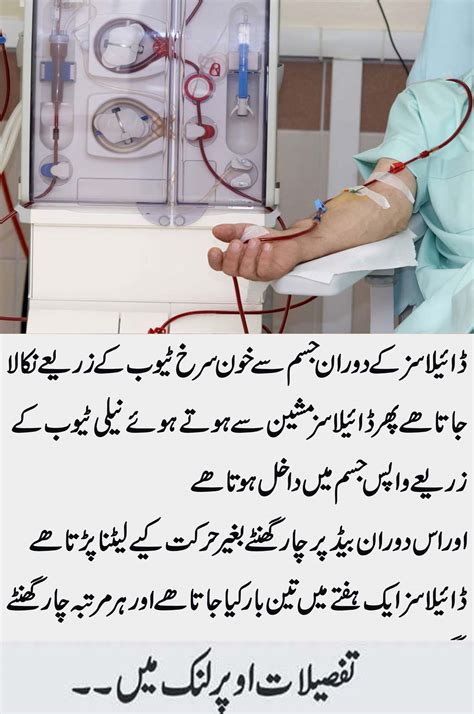 Hemodialysis Definition Procedure And Types Daily