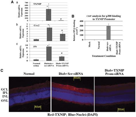 Txnip Tgs By Promoter Targeted Sirnas Inhibits Inflammation And Download Scientific Diagram