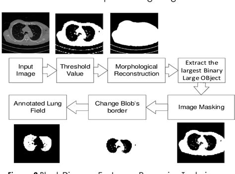 Figure 1 From Geometrical Feature Of Lung Lesion Identification Using Computed Tomography Scan
