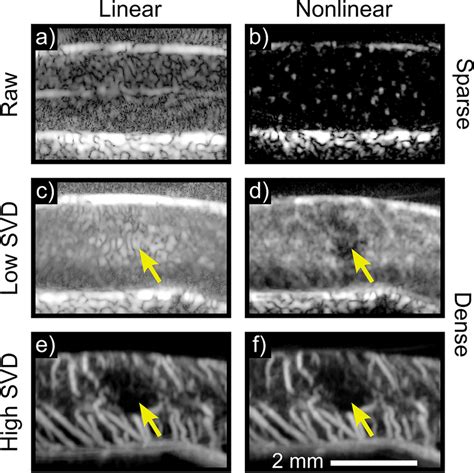 Nonlinear Imaging Is Necessary To Describe Tissue Perfusion Single Download Scientific Diagram