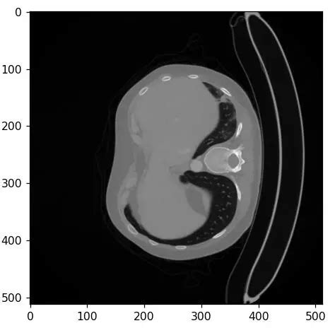 Read D NIFTI Images In Python Idiot Developer