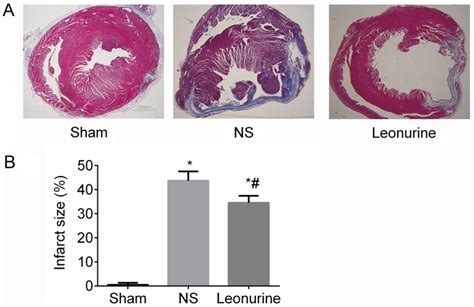 Leonurine Protects Cardiac Function Following Acute Myocardial