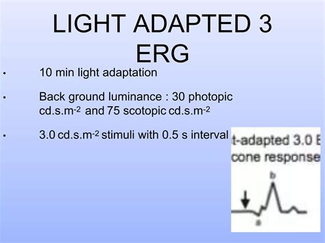 Electrophysiology Erg And Eog Simplified Pptx Eye And Vision Conditions Diseases