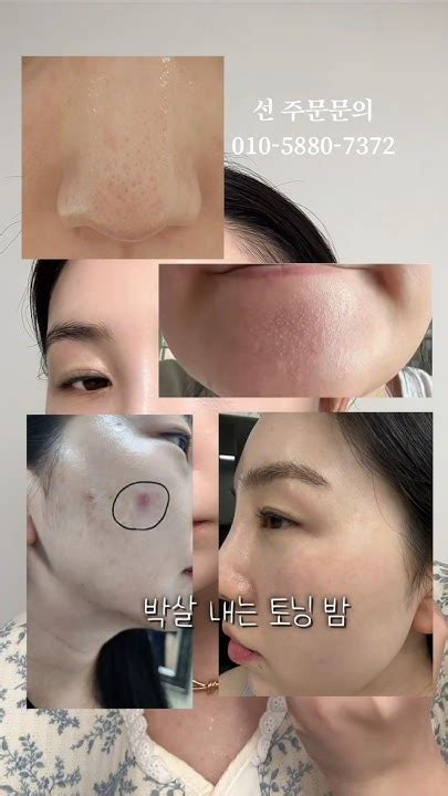 댓글확인기미블랙헤드색소요철 Youtube