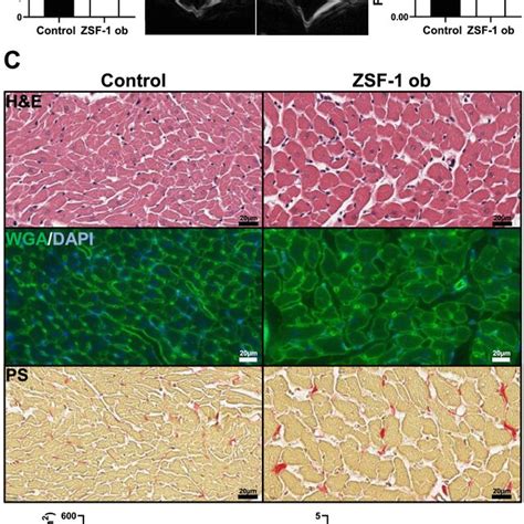 Zsf‐1 Obese Rats Exhibit Right Ventricular Hypertrophy A Gravimetric