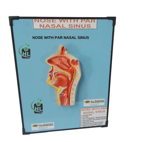 Myocardial Infarction Forensic Fiber Models 2d Model At ₹ 2900 Piece In Ambala