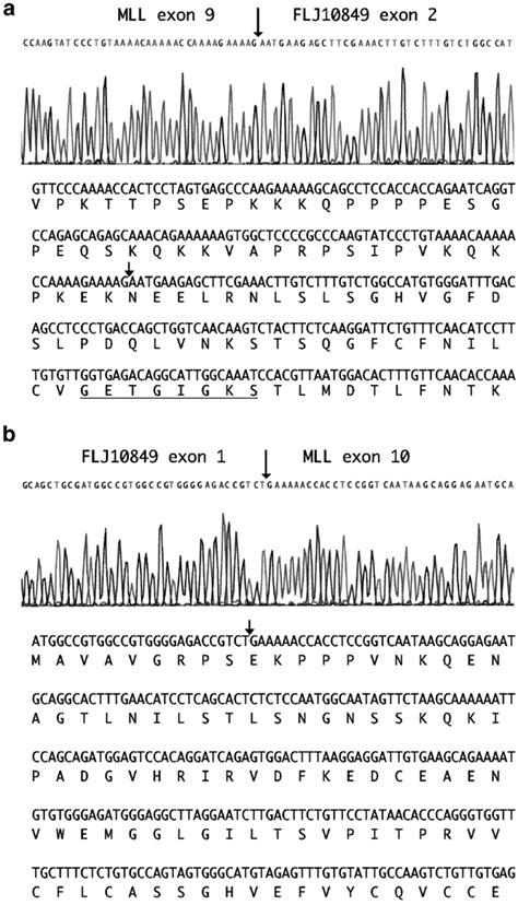 A Partial Sequence Of The Junction Of The Mll Flj10849 Chimeric Download Scientific Diagram