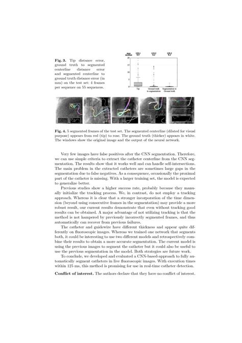 Fully Automatic And Real Time Catheter Segmentation In X Ray