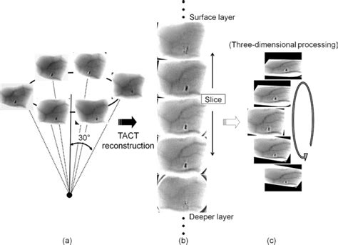 Qualitative Near Infrared Vascular Imaging System With Tuned Aperture