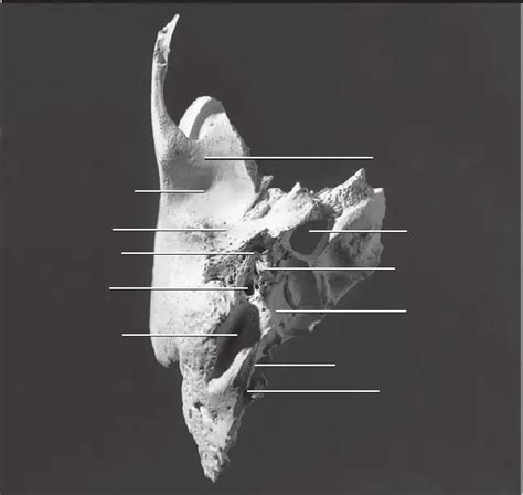 Temporal Inferior Diagram Quizlet