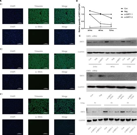Human Skin Primary Fibroblasts Were Obtained And Interfered With Sirt1