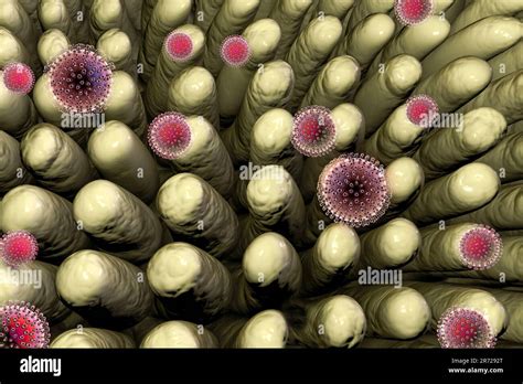 Rotaviruses Infecting Intestine Computer Artwork The Virus Particle Consists Of An Rna