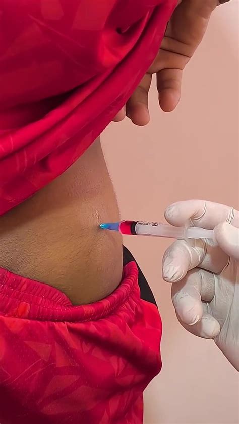 Injection In Gay Ass Video 6