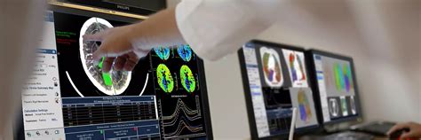 Optimization Services Philips