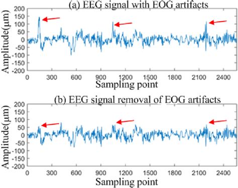 comparison of original eeg signal and removal of eog artifacts