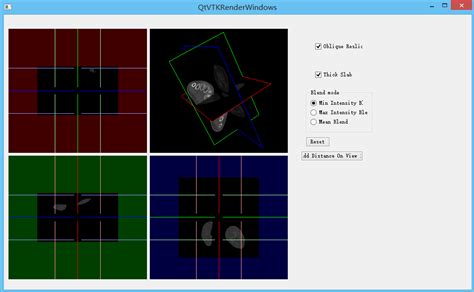 vtk examples中mip和mpr的功能实现与源码分析 vtk mip csdn博客