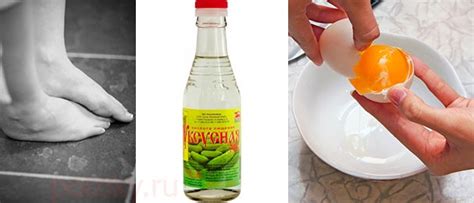 Если горят подошвы ног