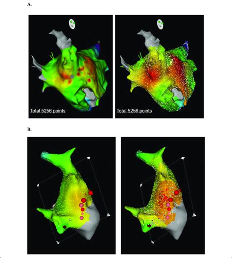 A Activation Map Of The Left Atrium During High Right Atrial Pacing Download Scientific