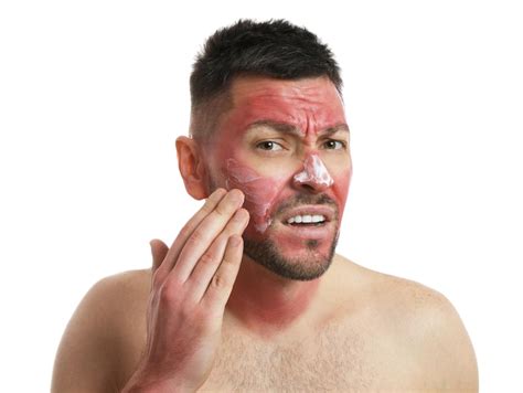 Premium Photo Man Applying Cream On Sunburn Against White Background