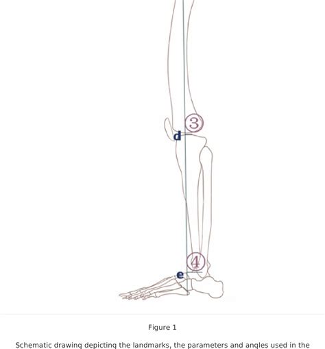 Figure 1 From The Difference Of Whole Body Sagittal Alignment In Different Postures In Young