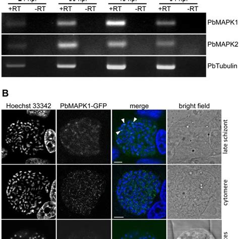 a transcripts encoding pbmapk1 and pbmapk2 are detectable in p